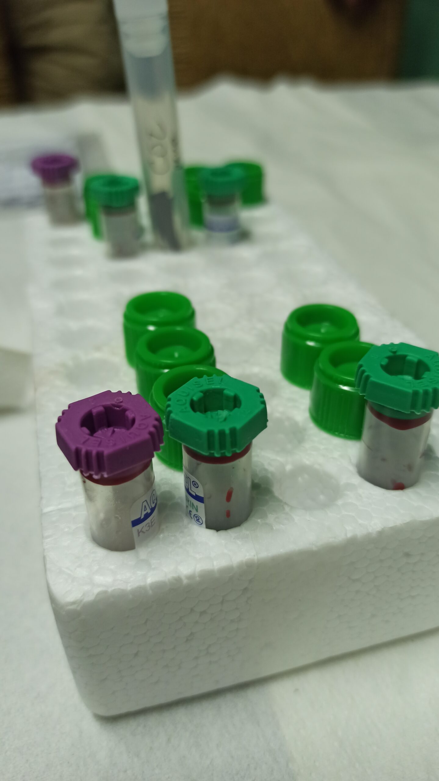 Tagging Cinereous Vultures in the nest, step by step - Vulture ...